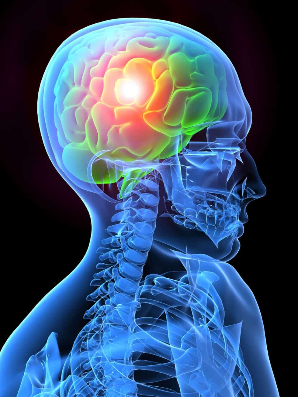 Article sur l'ARSACS publié dans la revue Neuropathology and Applied ...